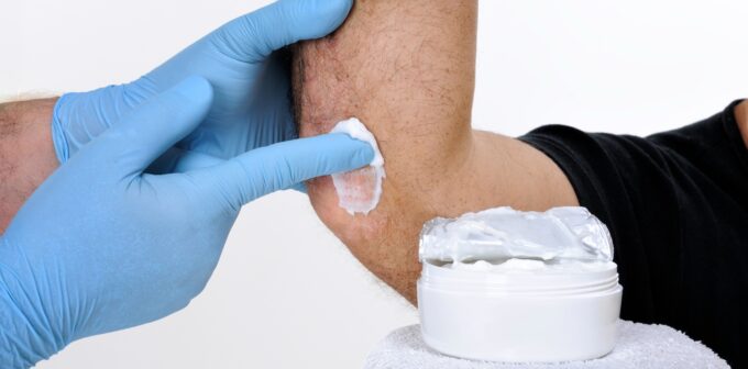 Hope for new plaque psoriasis treatment - Dermatology Republic