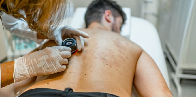 Skin cancer check numbers better, but still not great - Dermatology ...